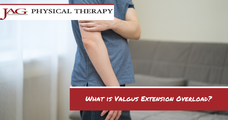 What is Valgus Extension Overload? | JAG PT